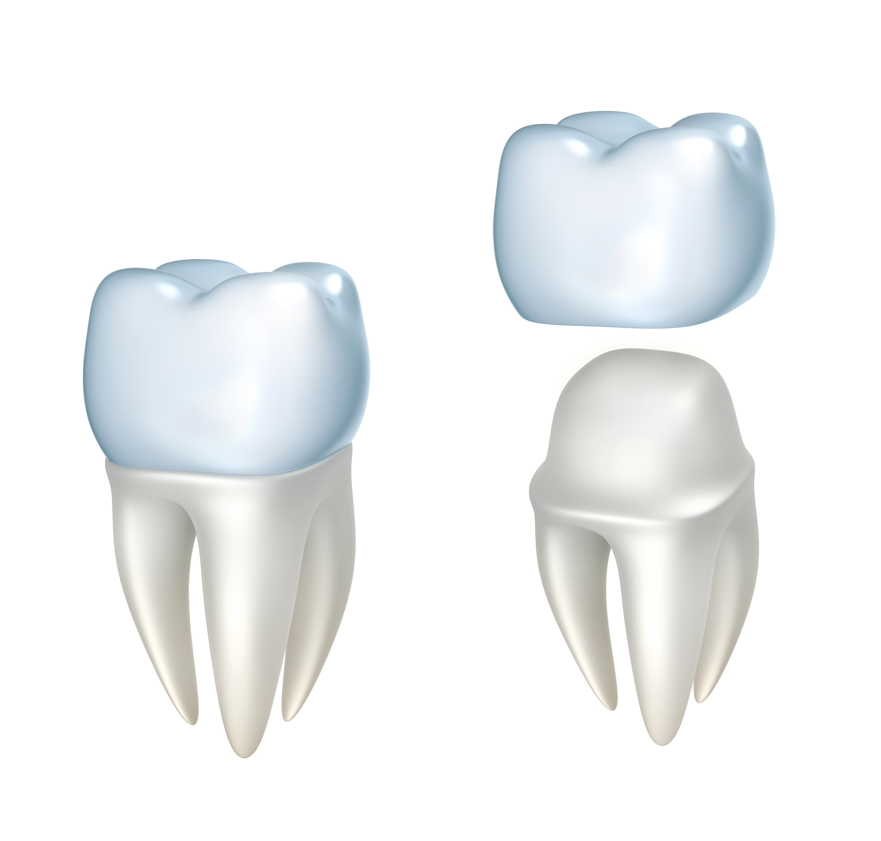 Dental Crowns Columbus GA | Tooth Crowns Fort Benning